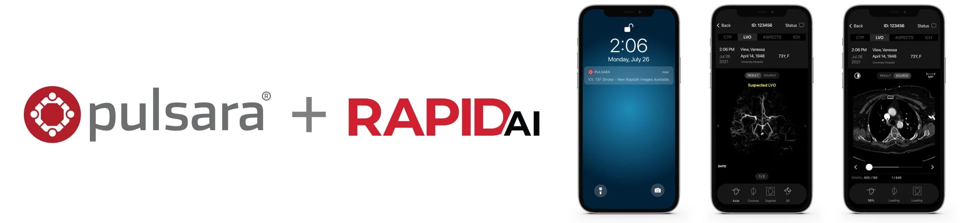 Pulsara + RapidAI
