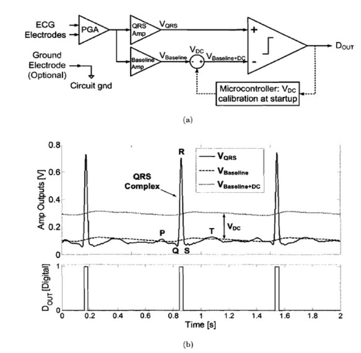 Under the Hood of an EKG