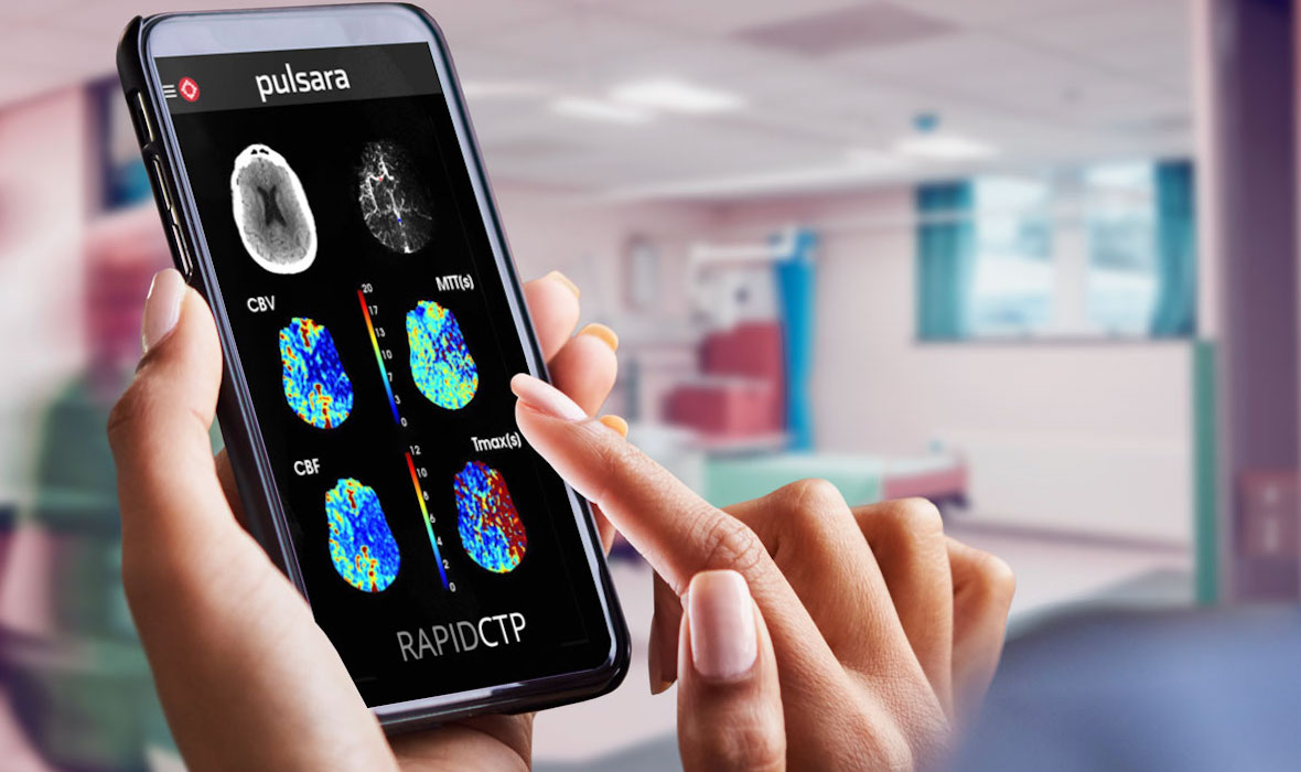 The Power of Connected Teams: Thoughts on the Pulsara and iSchemaView ...