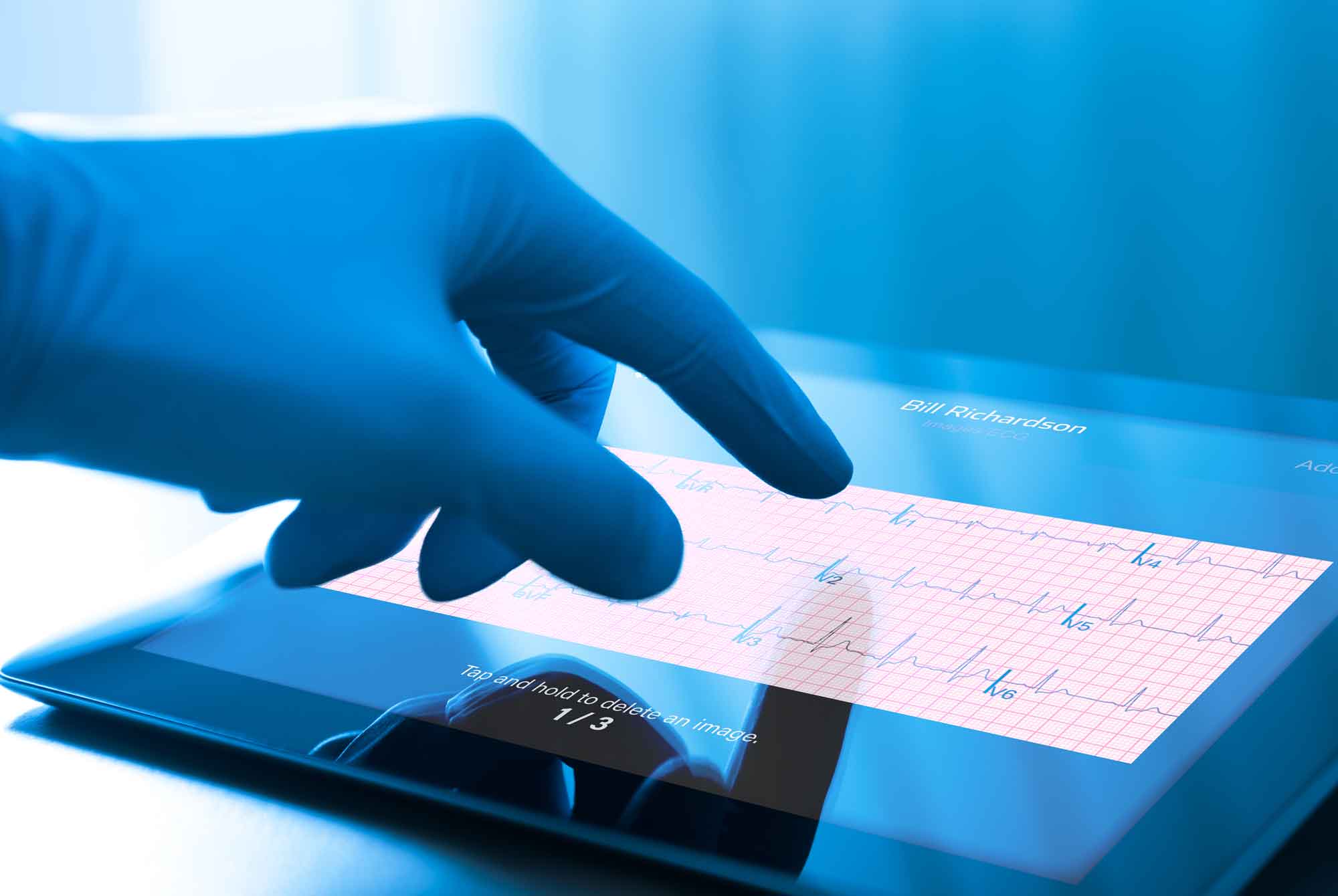 Pulsara | Improve STEMI, Stroke and EMS Treatment Times